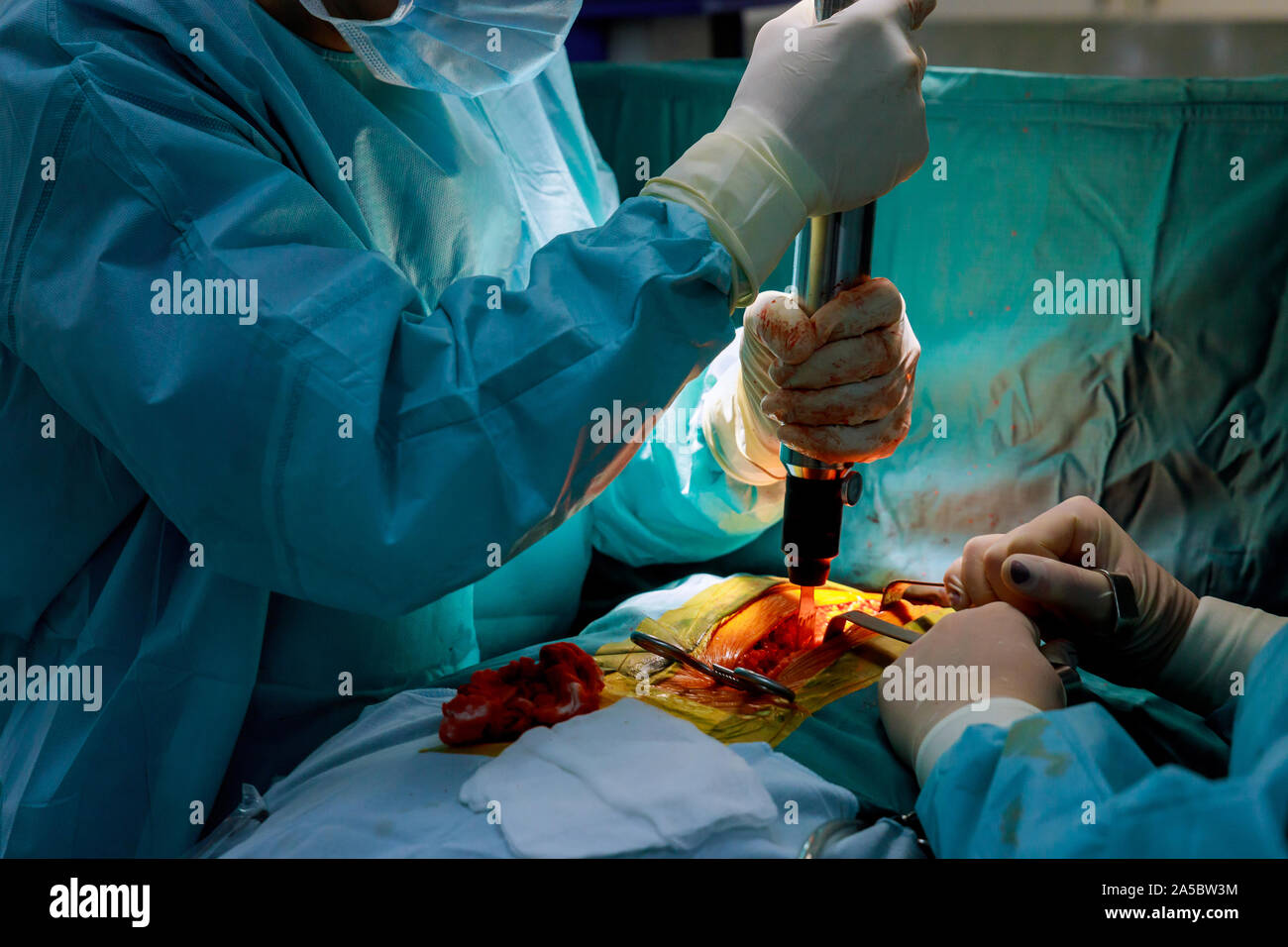 Cut and shunt hi-res stock photography and images - Alamy