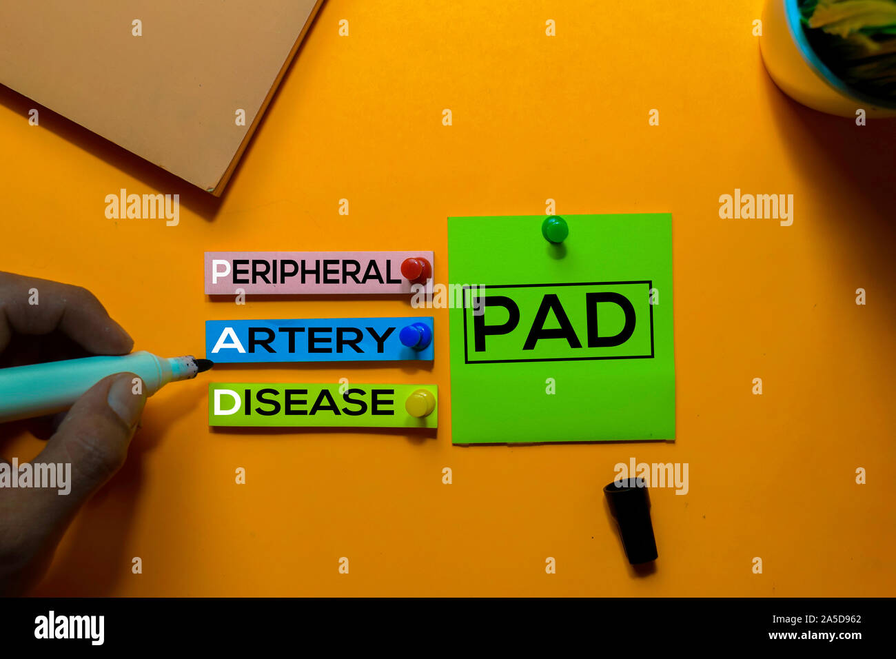 Peripheral artery disease hi-res stock photography and images - Alamy