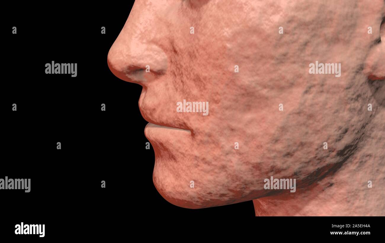 Skin Problems : old, cracked, dry skin on face . 3d render Stock Photo ...