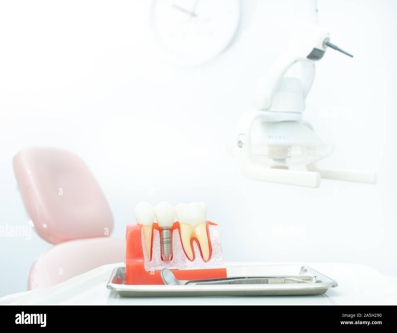 Plastic dental implant model for education patient Stock Photo - Alamy