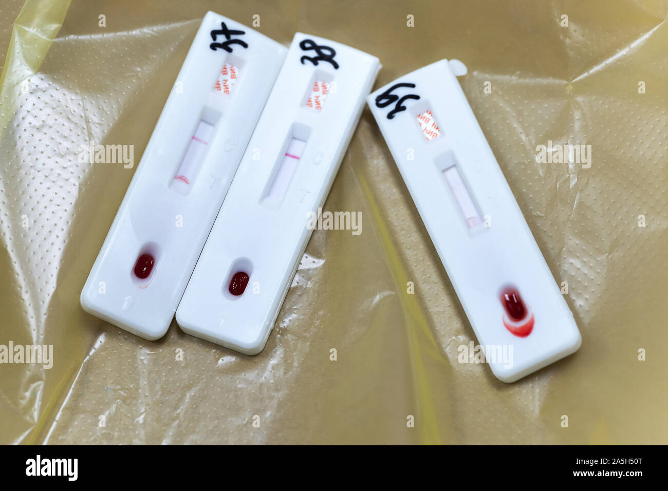 Russian test for express diagnosis of specific antibodies to human ...