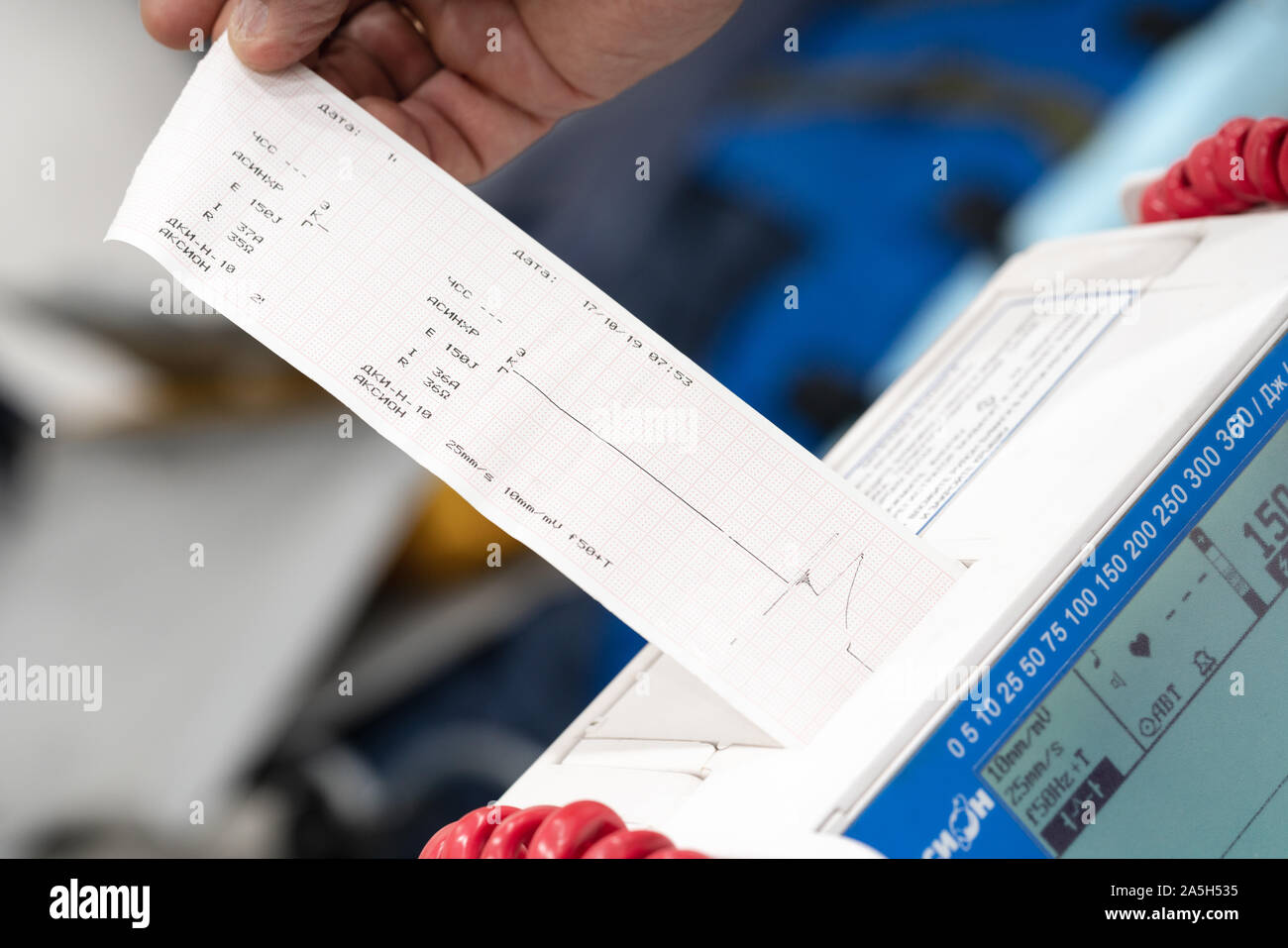 Ventricular fibrillation hi-res stock photography and images - Alamy