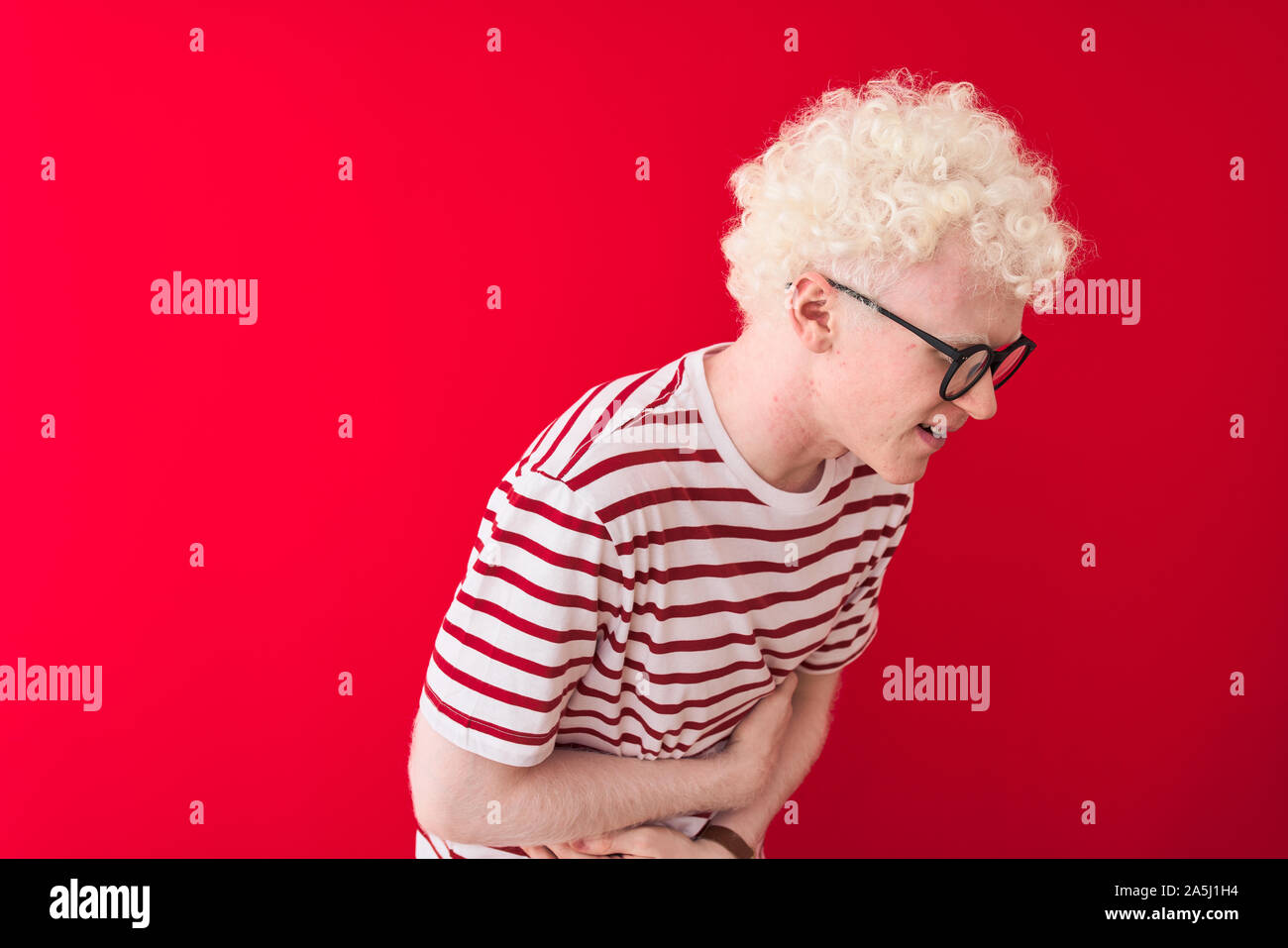 Young albino blond man wearing striped t-shirt and glasses over ...