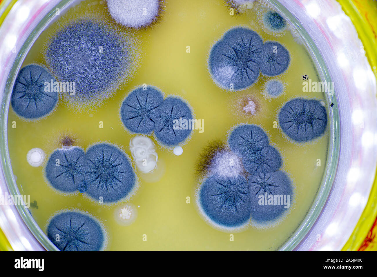 Skin bacteria microscope hi-res stock photography and images - Alamy