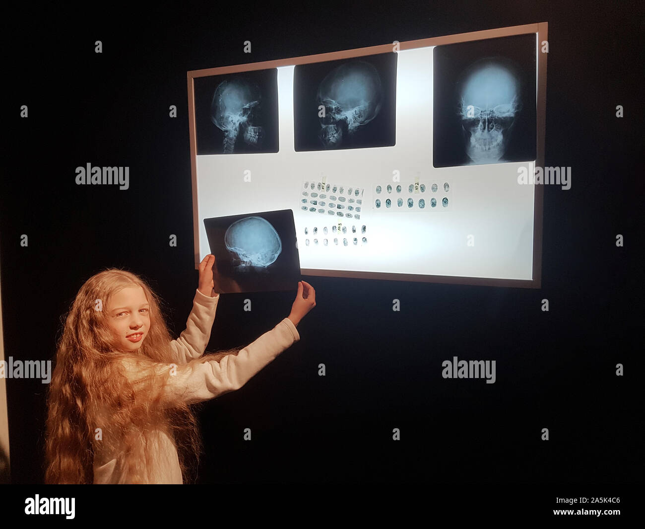 Forensic skull analysis hi-res stock photography and images - Alamy