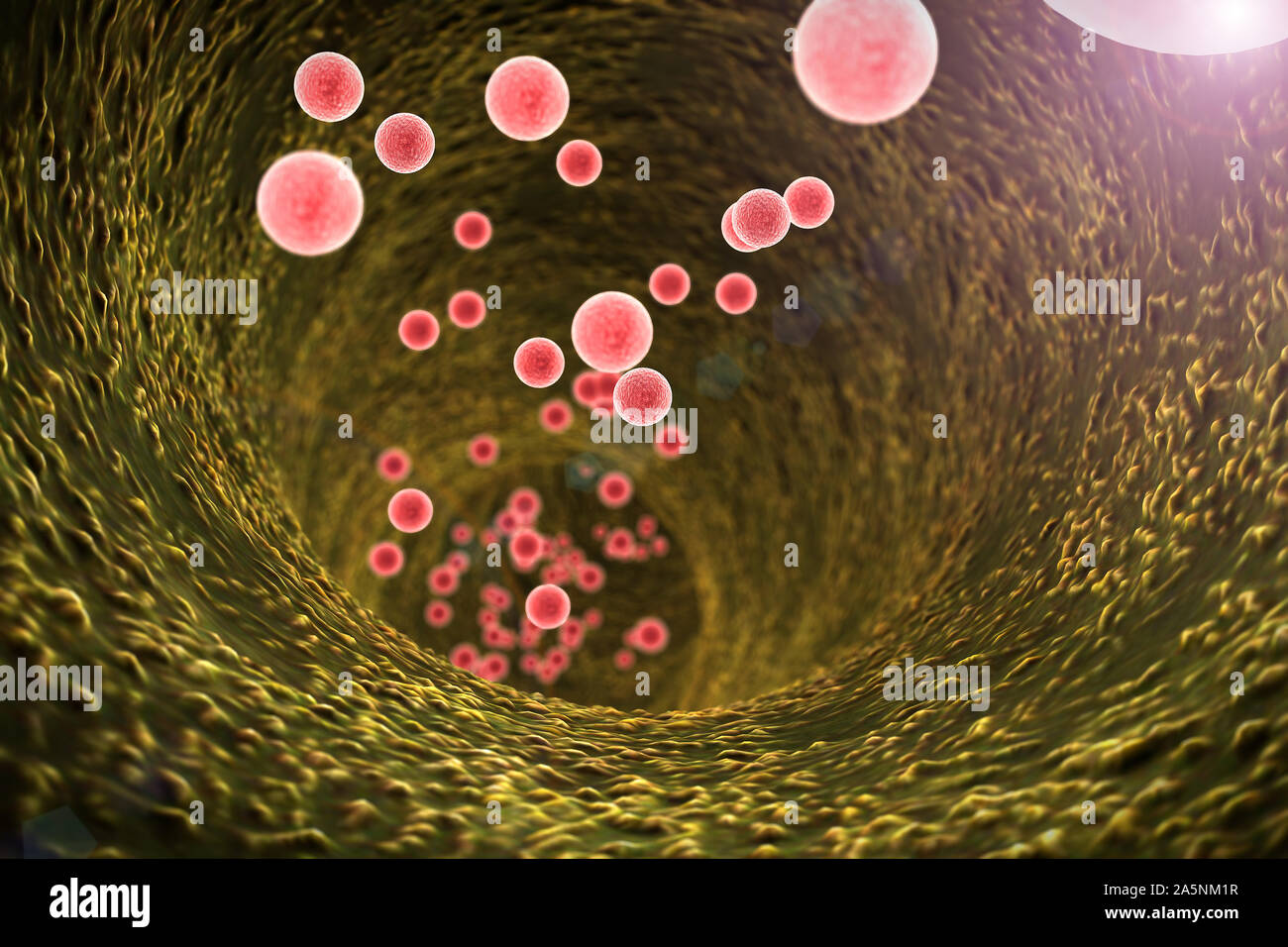 inside of the esophagus, white blood cells inside the blood vessel ...