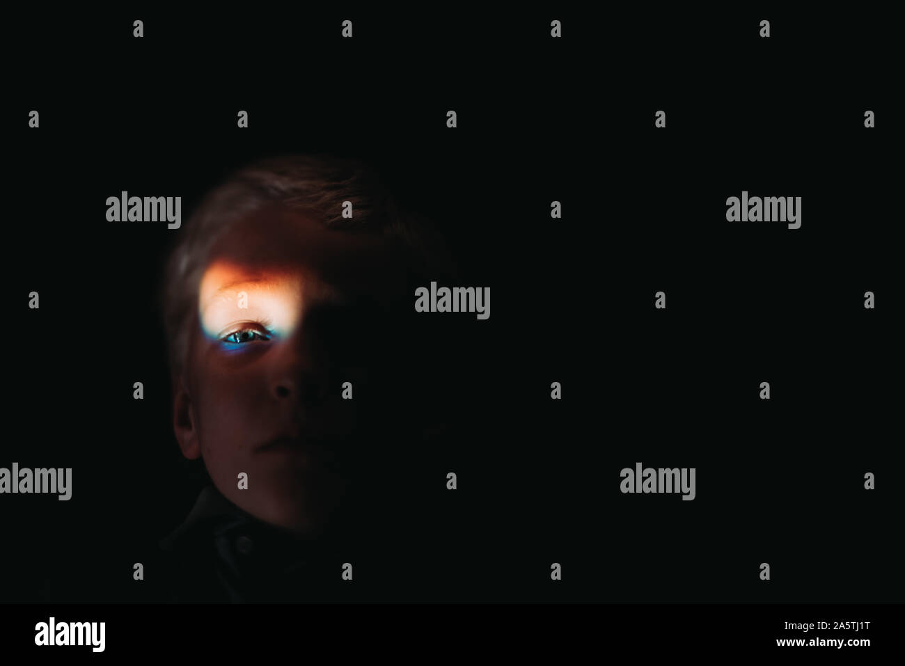 Boy with black eye hi-res stock photography and images - Alamy