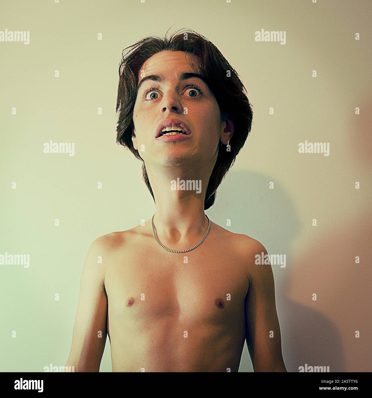 Swollen head hi-res stock photography and images - Alamy