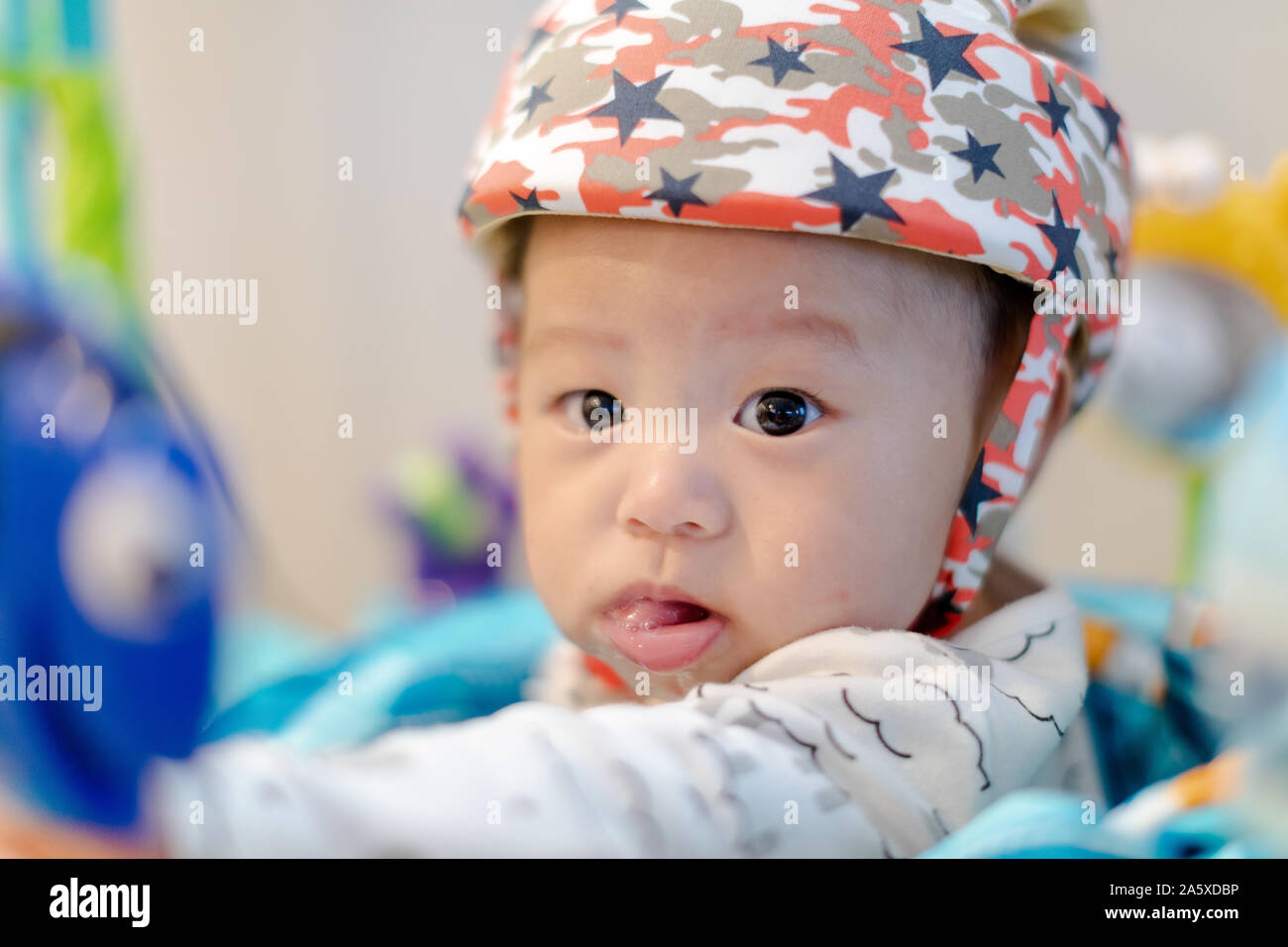 Adorable 4 month old asian baby boy with an orthopedic helmet Stock ...