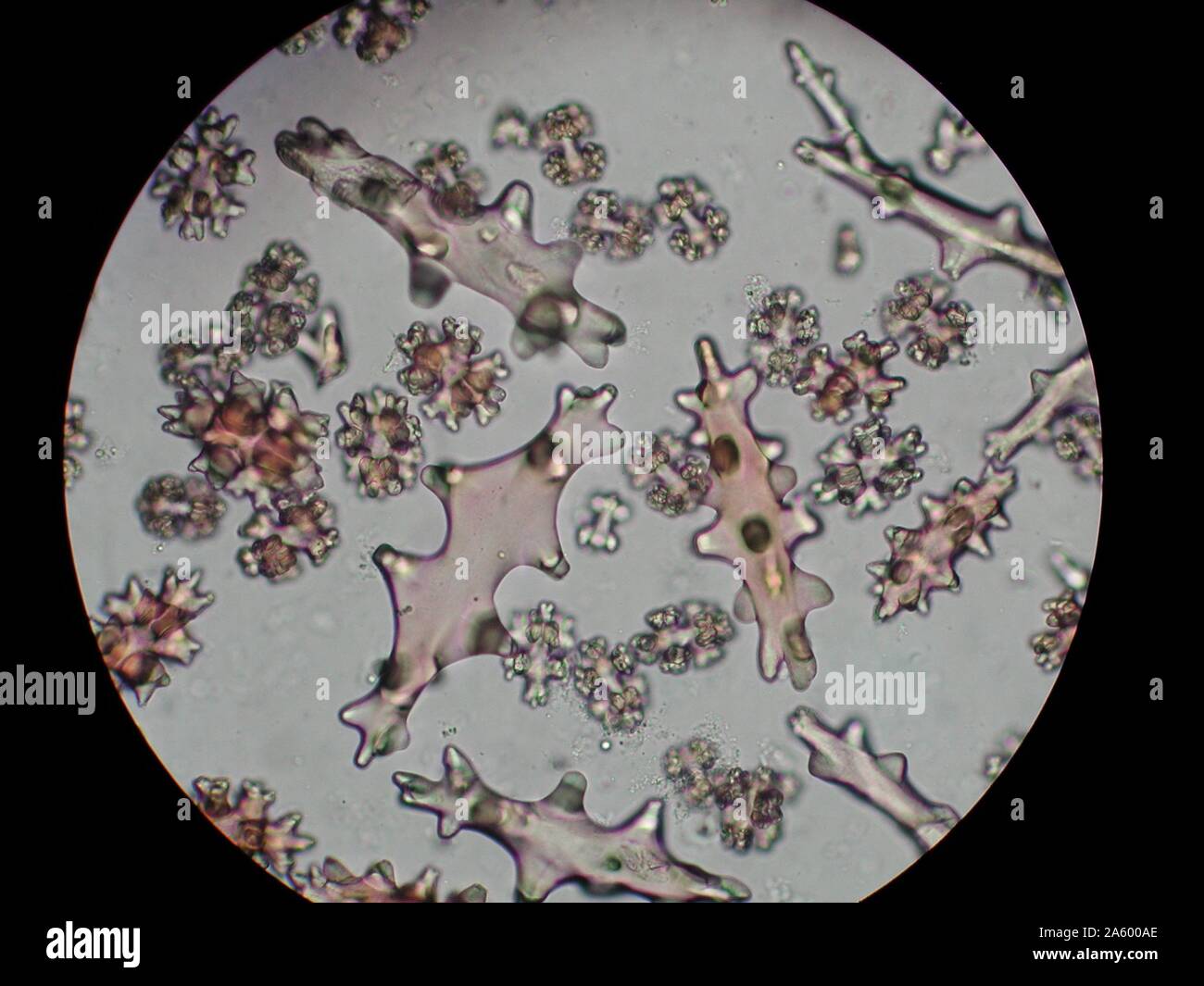 Gulf of Alaska Seamount Expedition. Paragorgia sclerites seen under the ...