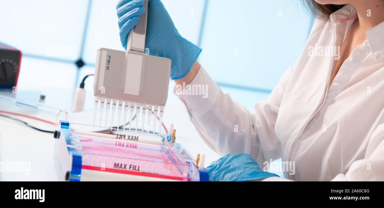 Loading Samples and Running an Agarose Gel for electrophoresis, Gel ...