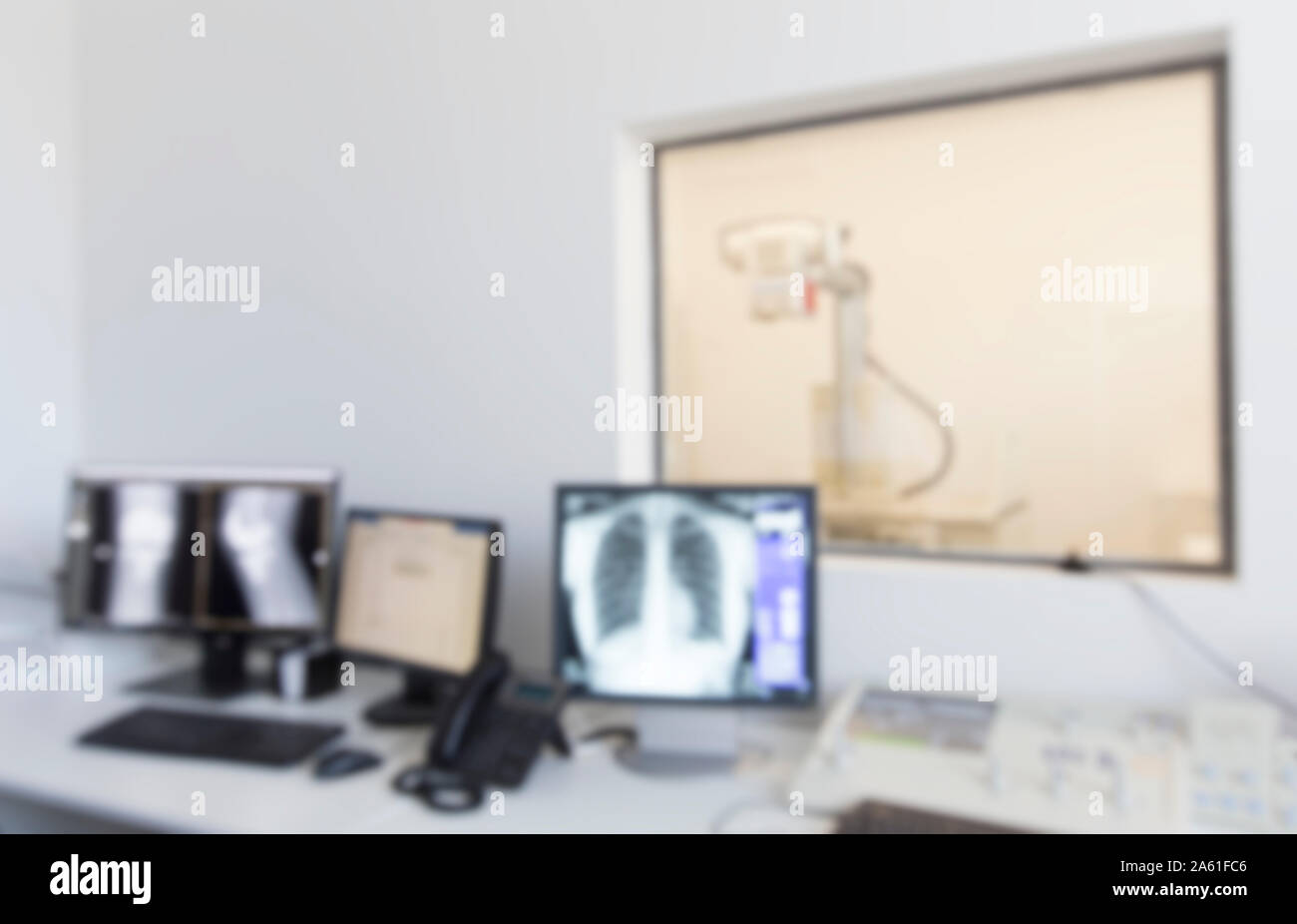 X-ray of chest and knee on modern computers in laboratory Stock Photo ...