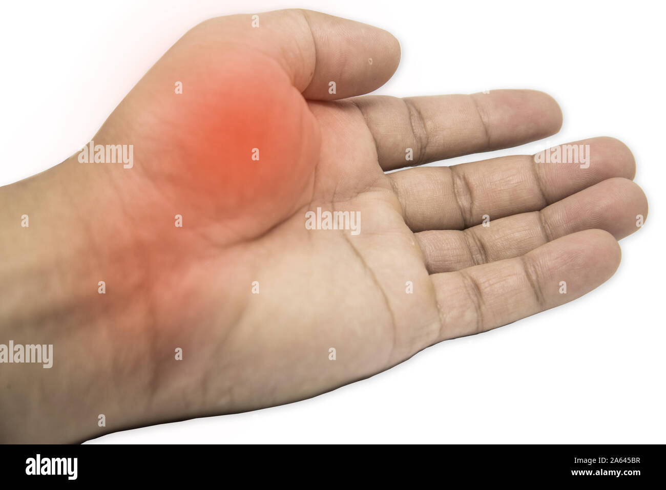 Trigger finger, arthritis, wrist pain isolated on white background with ...