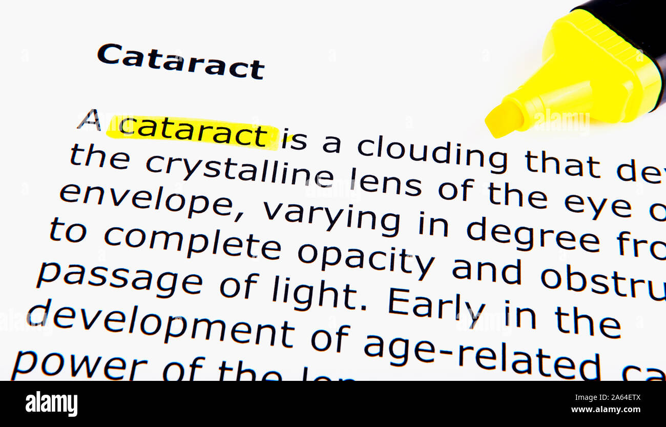 Cataracts human eye hi-res stock photography and images - Alamy