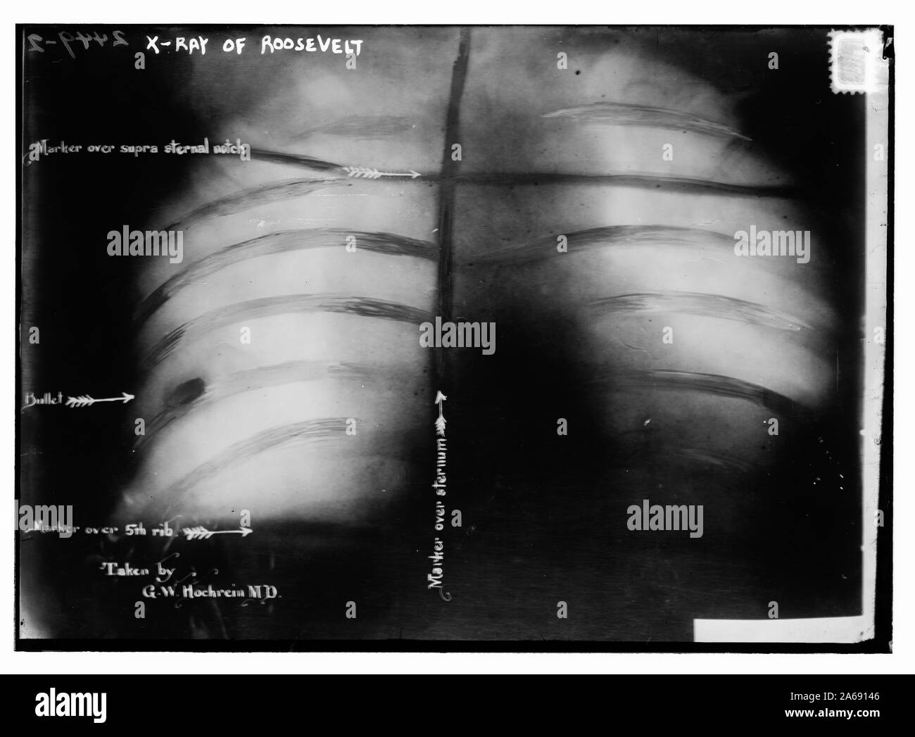 Bullet x ray hi-res stock photography and images - Alamy