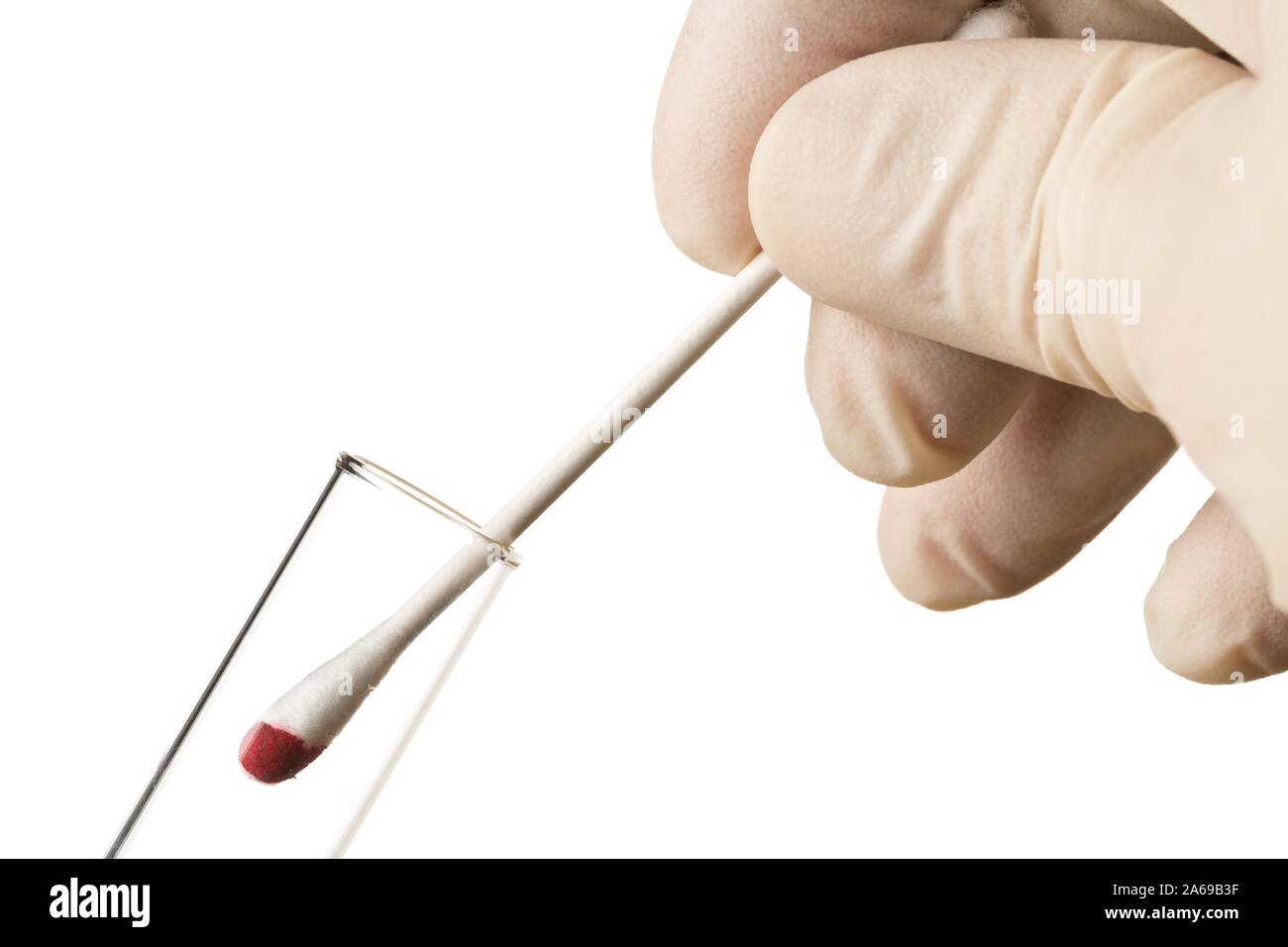 Buccal swab hi-res stock photography and images - Alamy