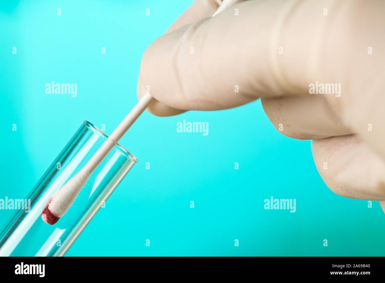Buccal swab hi-res stock photography and images - Alamy