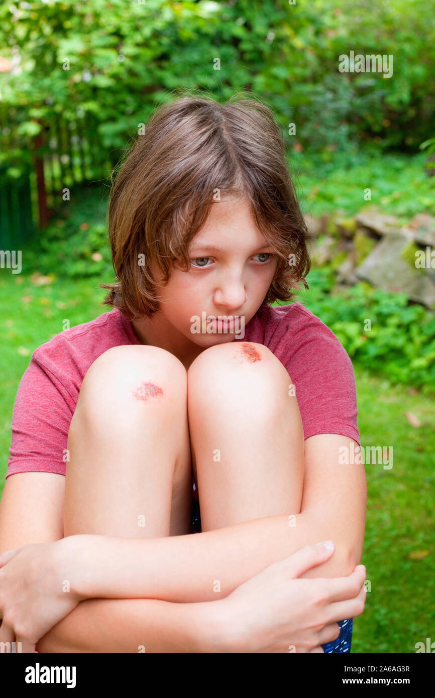 Boy with bruised knee caps in the garden Stock Photo - Alamy