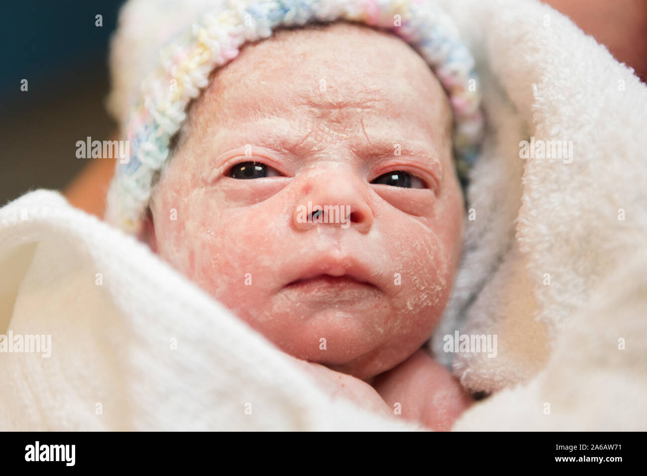 A young baby girl is born premature weighing just 4lbs, pictured here ...