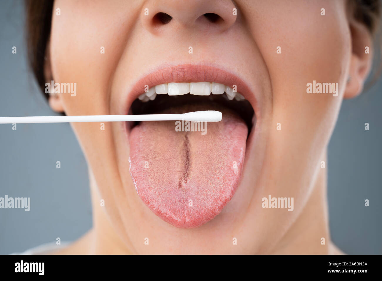 Dentist Taking Saliva Test Of A Patient Stock Photo - Alamy