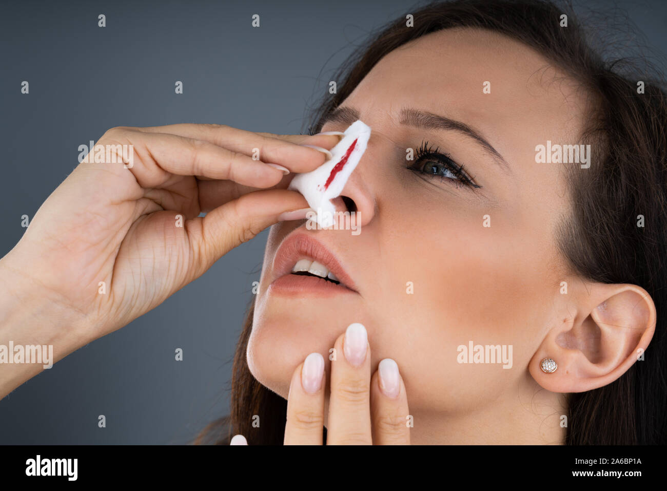 Woman Trying To Stop Blood Bleeding From Nose Stock Photo - Alamy