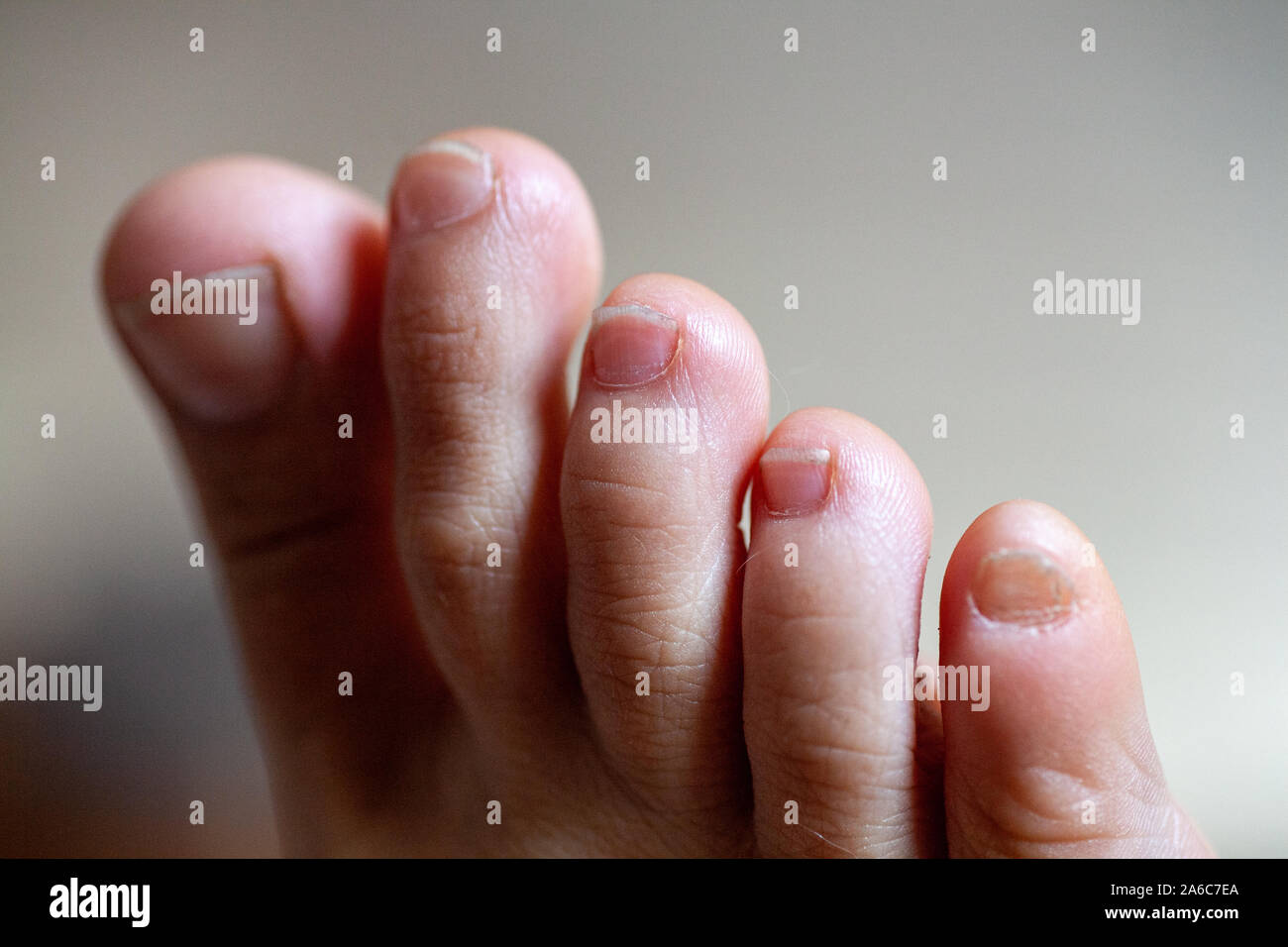 young girl's toes are healthy and beautiful. Well-groomed Concept for ...