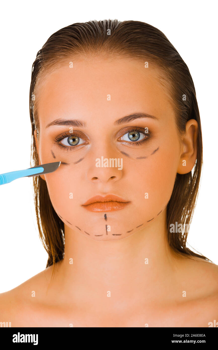 Woman face with surgical marks for operation. Lifting skin and removing ...