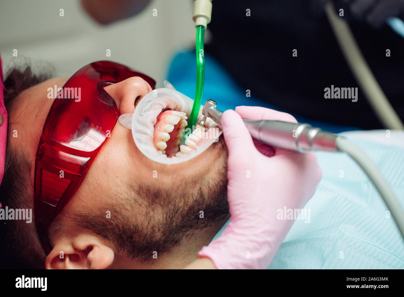 Professional teeth cleaning. Dentist cleans the teeth of a male patient ...