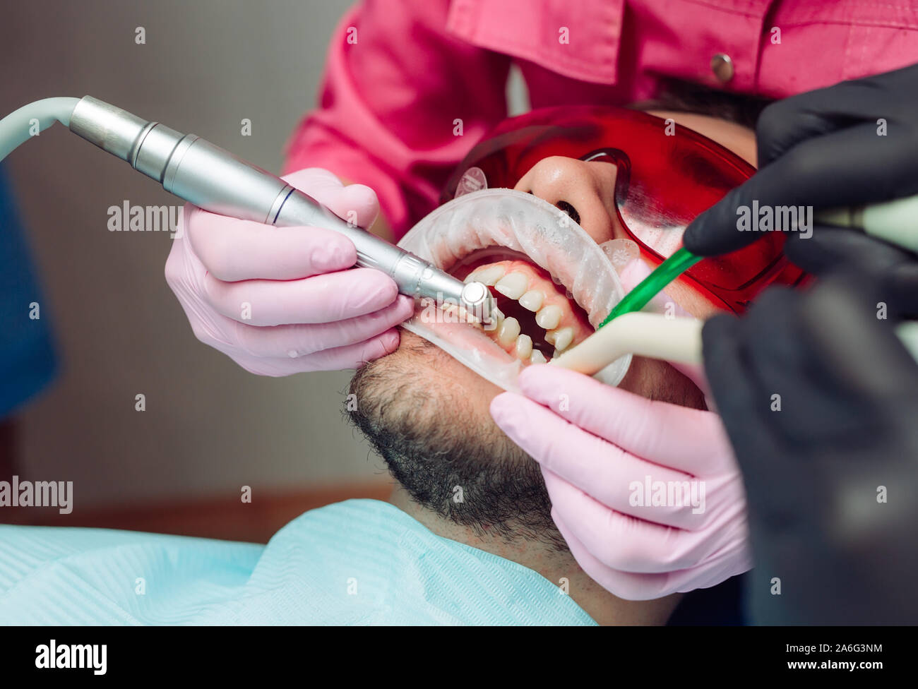 Professional teeth cleaning. Dentist cleans the teeth of a male patient ...