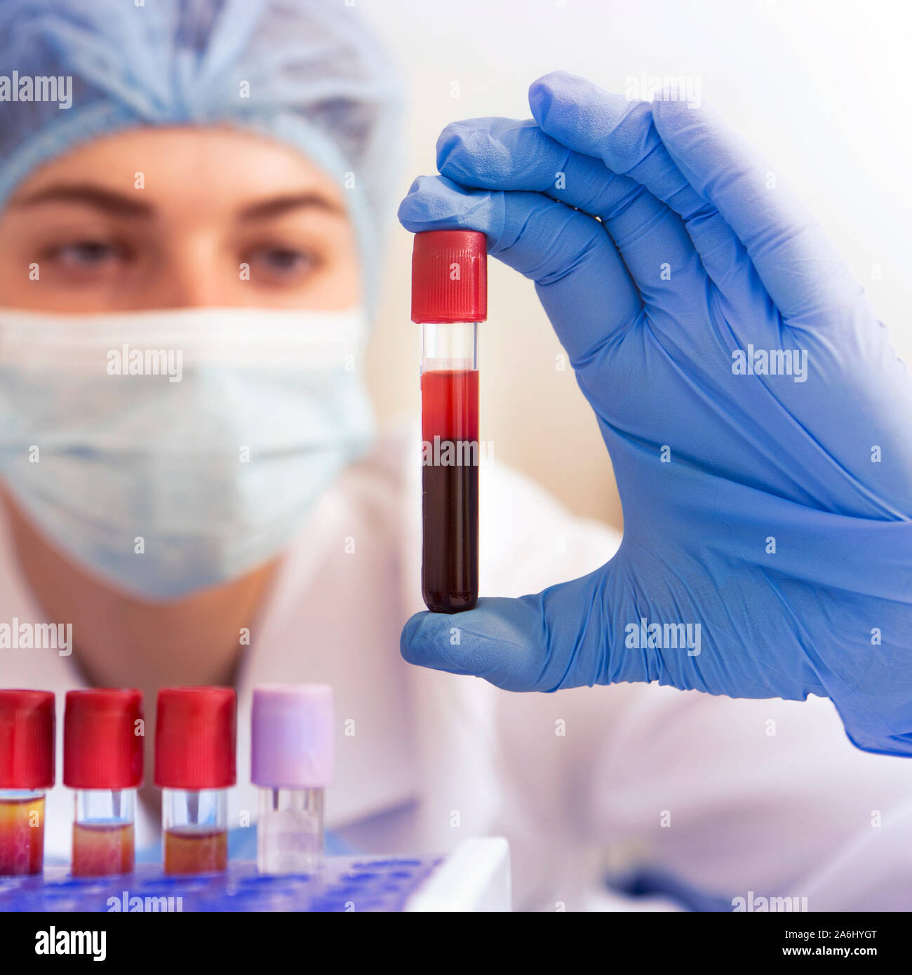 Woman lab worker holding test tube doing blood analysis Stock Photo - Alamy