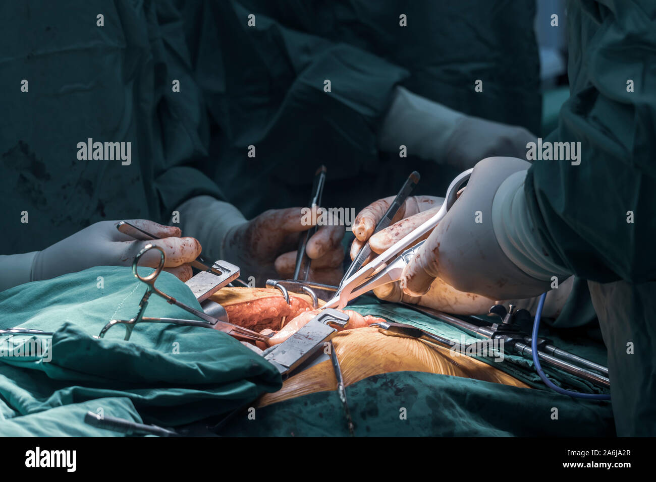 Group surgery hi-res stock photography and images - Alamy