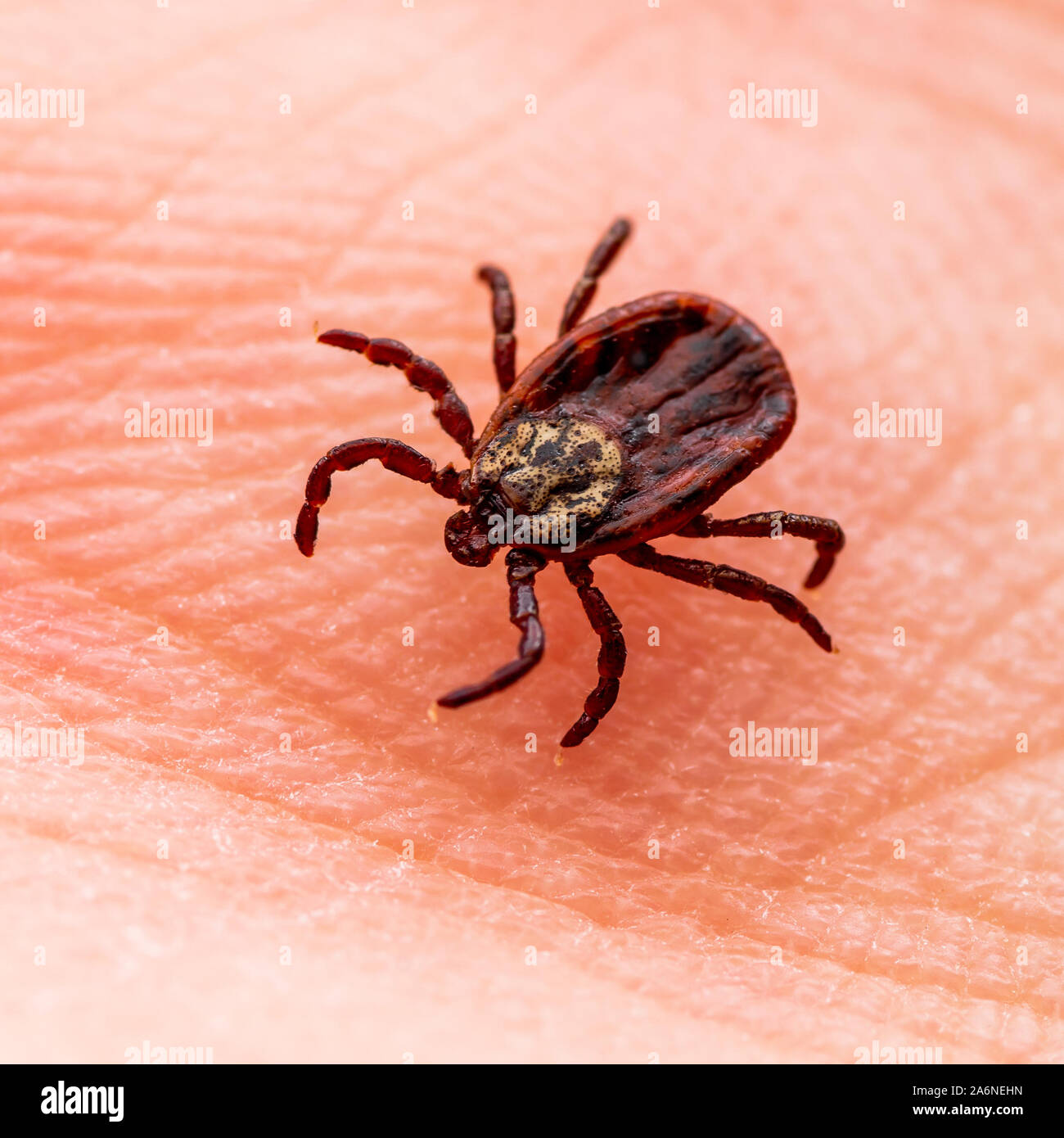 Encephalitis Virus or Lyme Borreliosis Disease Infectious Dermacentor ...