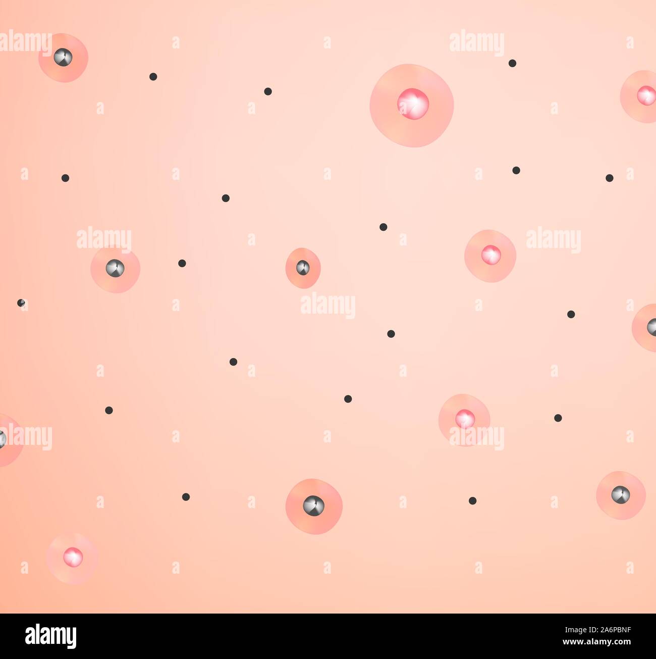 Stage 2 of development of acne. Inflamed skin with scars, acne and ...