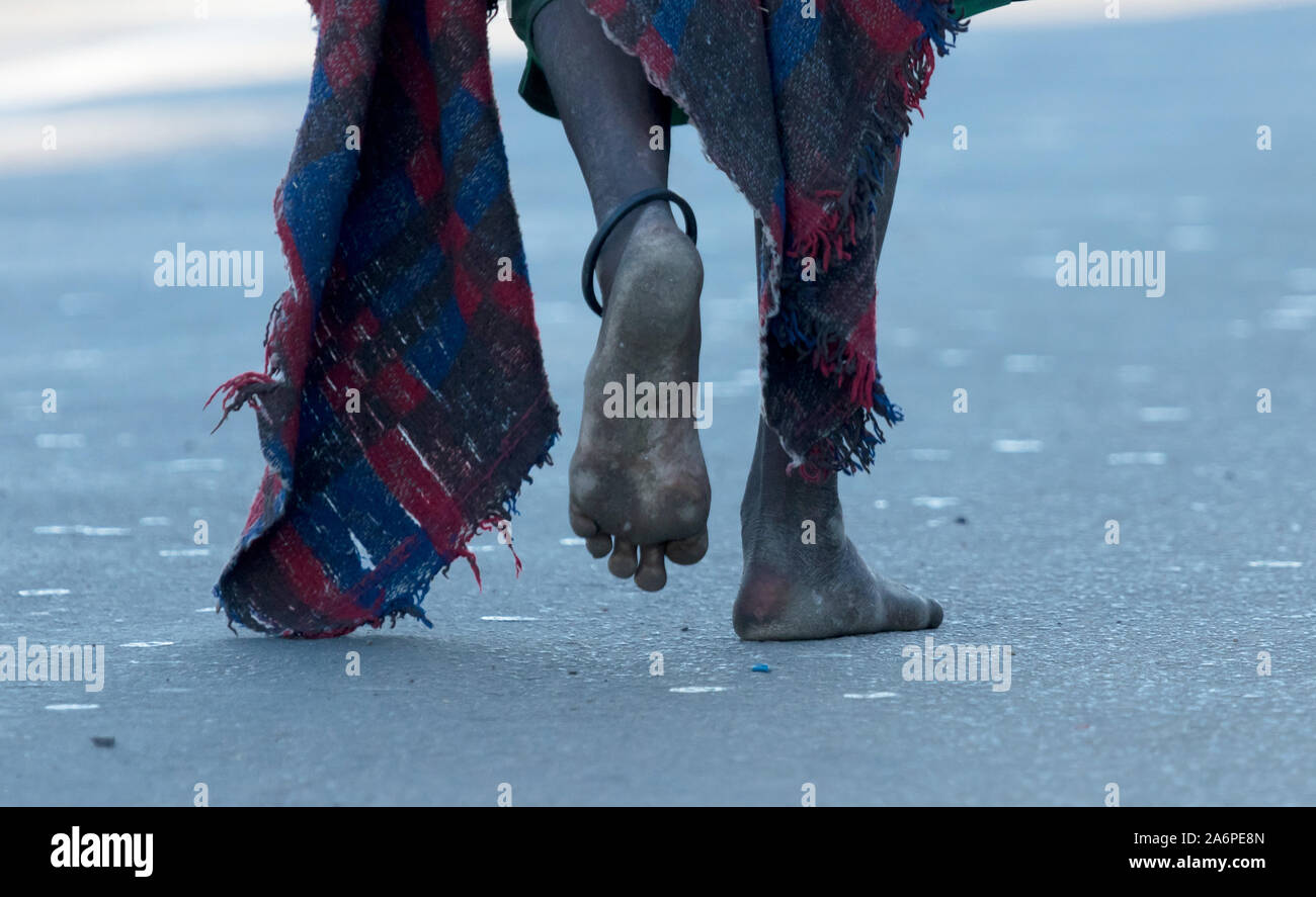 Poverty in Africa - Man wlaking barefoot on a road - Madagascar Stock ...
