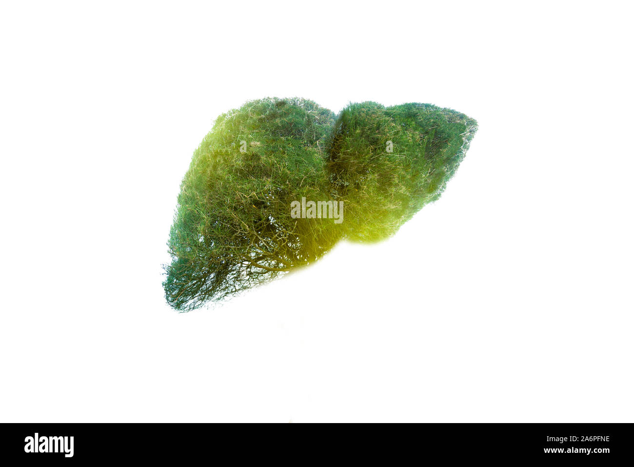Realistic liver images are human green tree shapes about diseases and ...