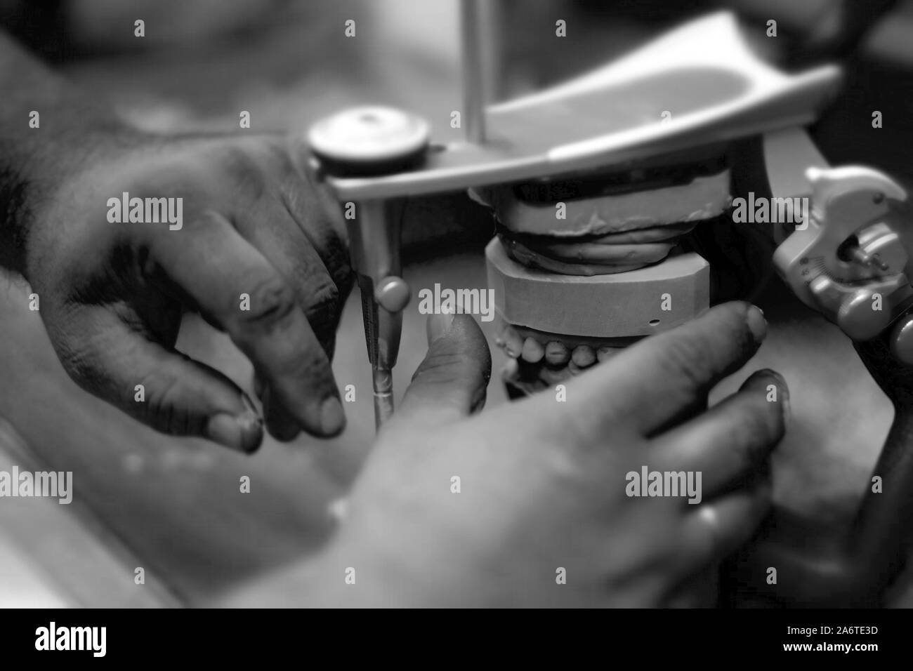 Hands of a specialist in the process of manufacturing a prosthesis in a ...