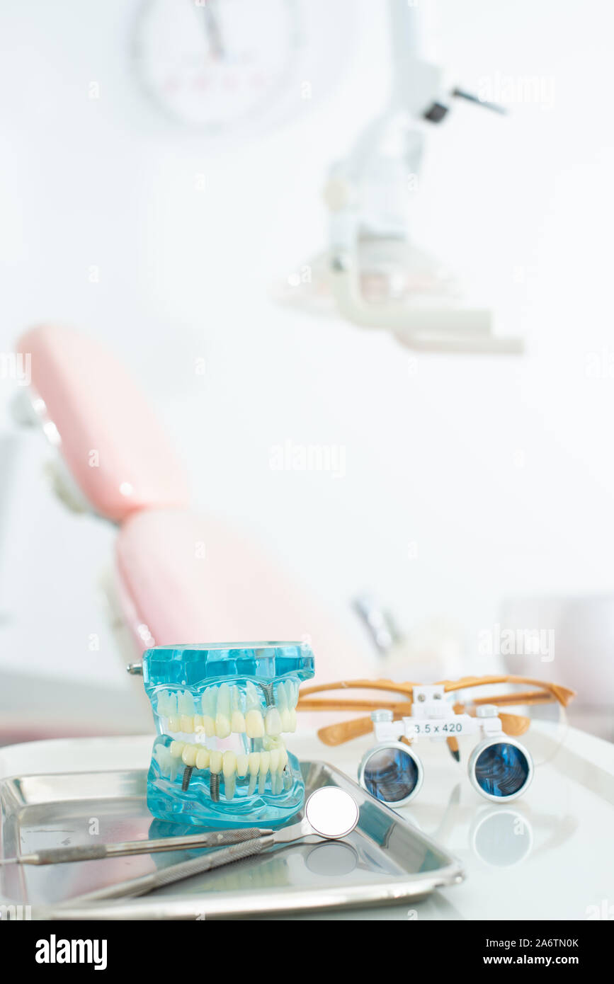 Dental implant model for patient example dental implant Stock Photo - Alamy