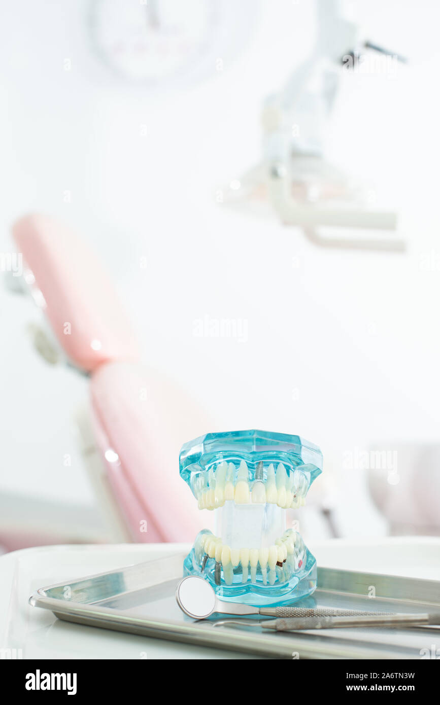 Dental implant model for patient example dental implant Stock Photo - Alamy