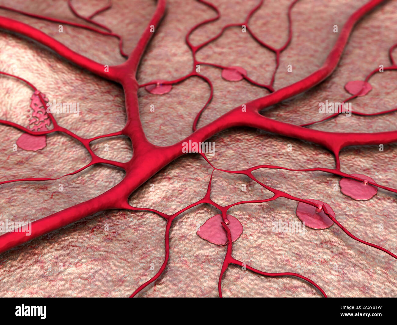 disease of Capillary, circulatory system, blood vessel Stock Photo - Alamy