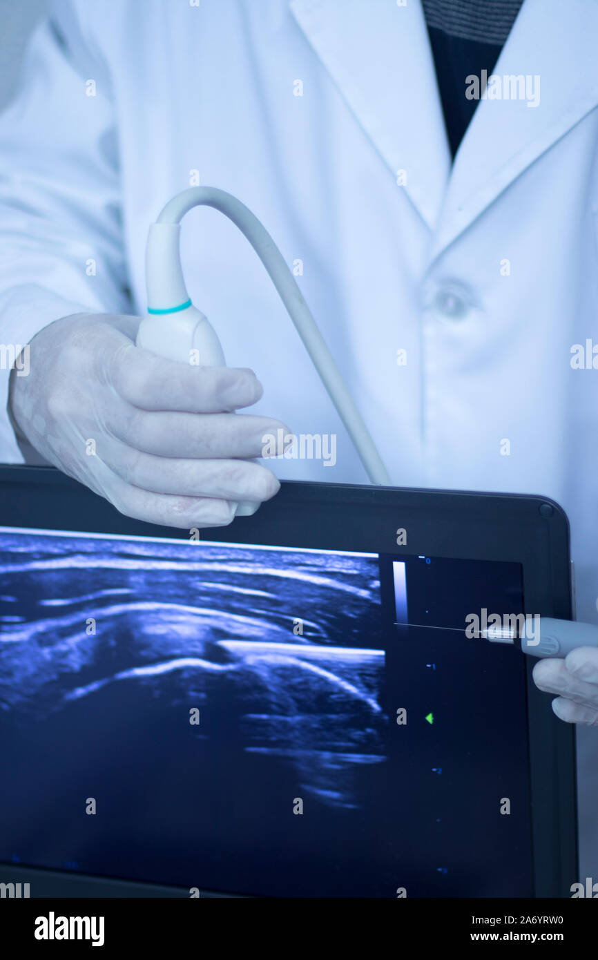 Epi percutaneous intratissue electrolysis scan hi-res stock photography and images - Alamy