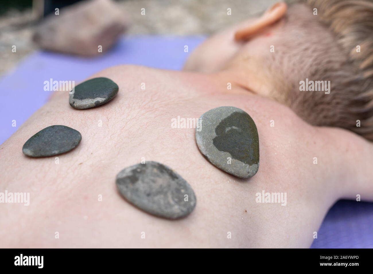 Stone therapy. pebbles laid out on the back of the boy. The boy lies in ...