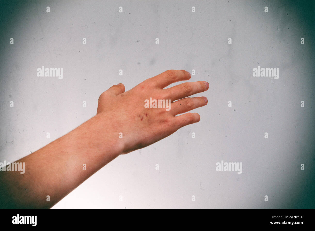 hand arm of young man image of Stock Photo - Alamy