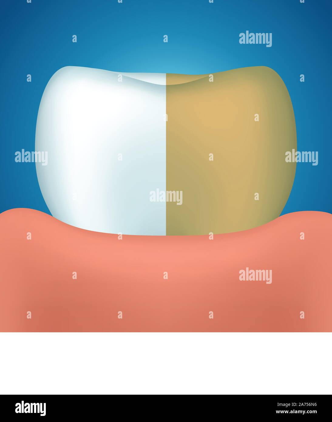 tooth on blue Stock Vector Image & Art - Alamy
