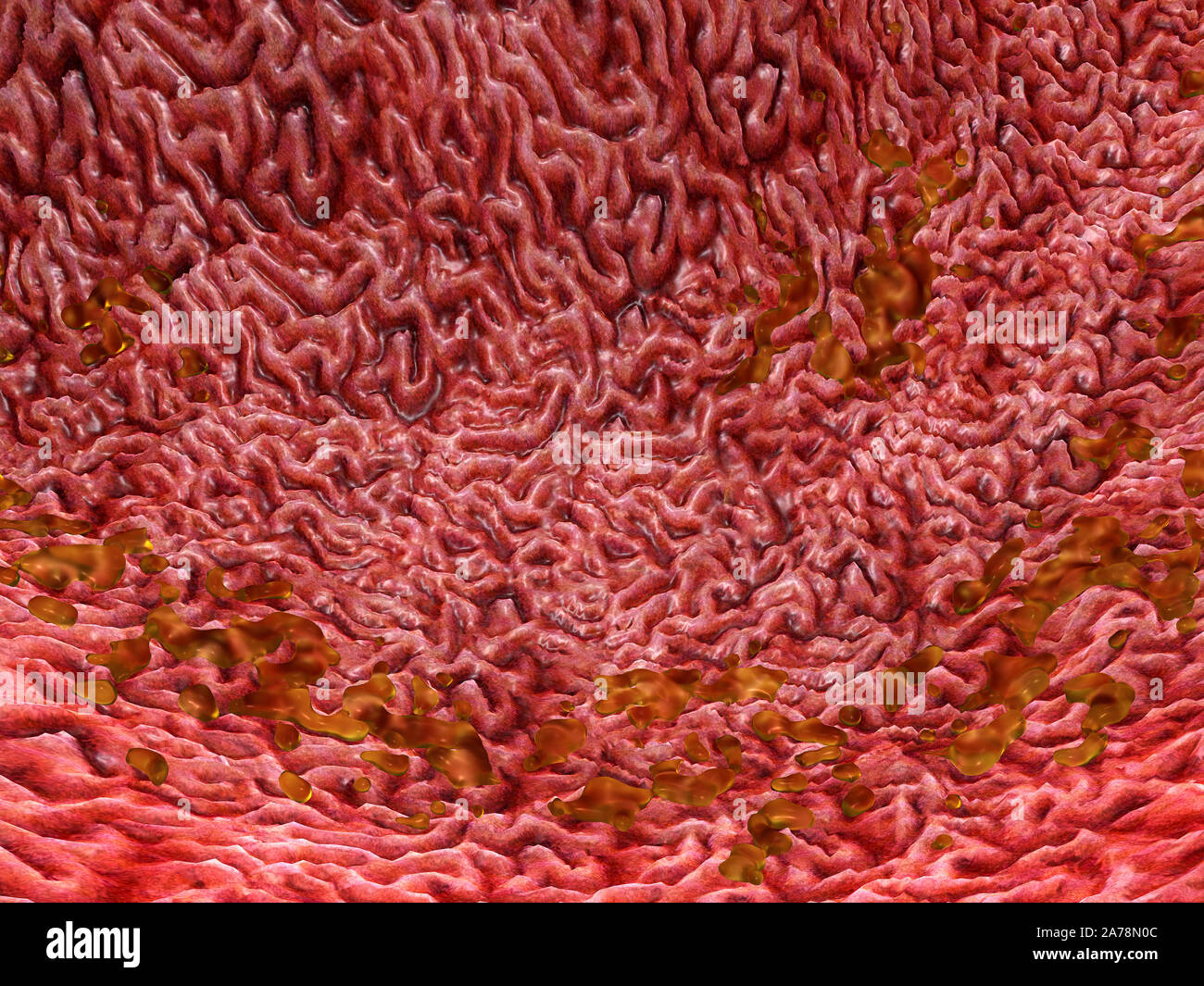 Inside Stomach Pictures