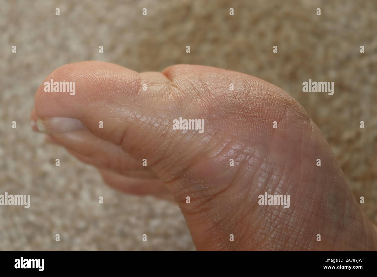 Dryness skin hi-res stock photography and images - Alamy