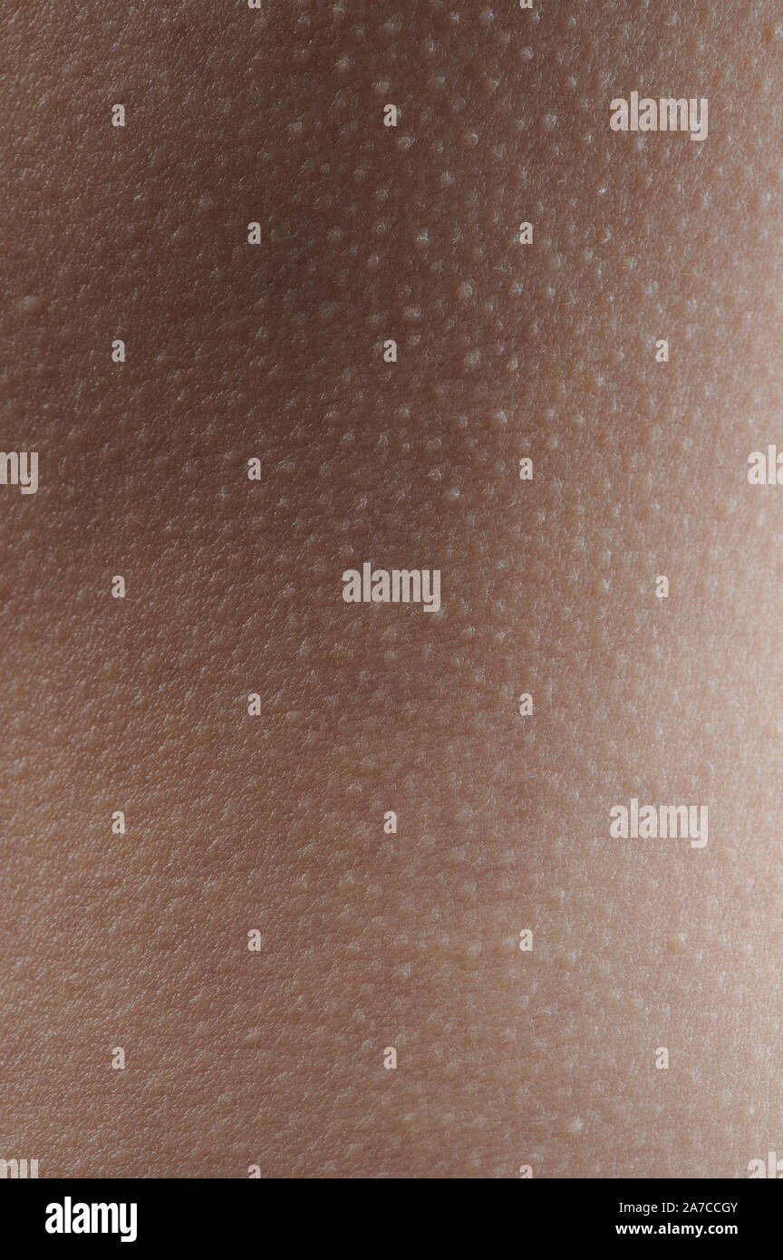 Goose bumps skin hi-res stock photography and images - Alamy