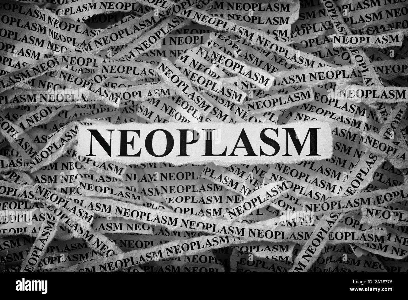 Neoplasia hi-res stock photography and images - Alamy