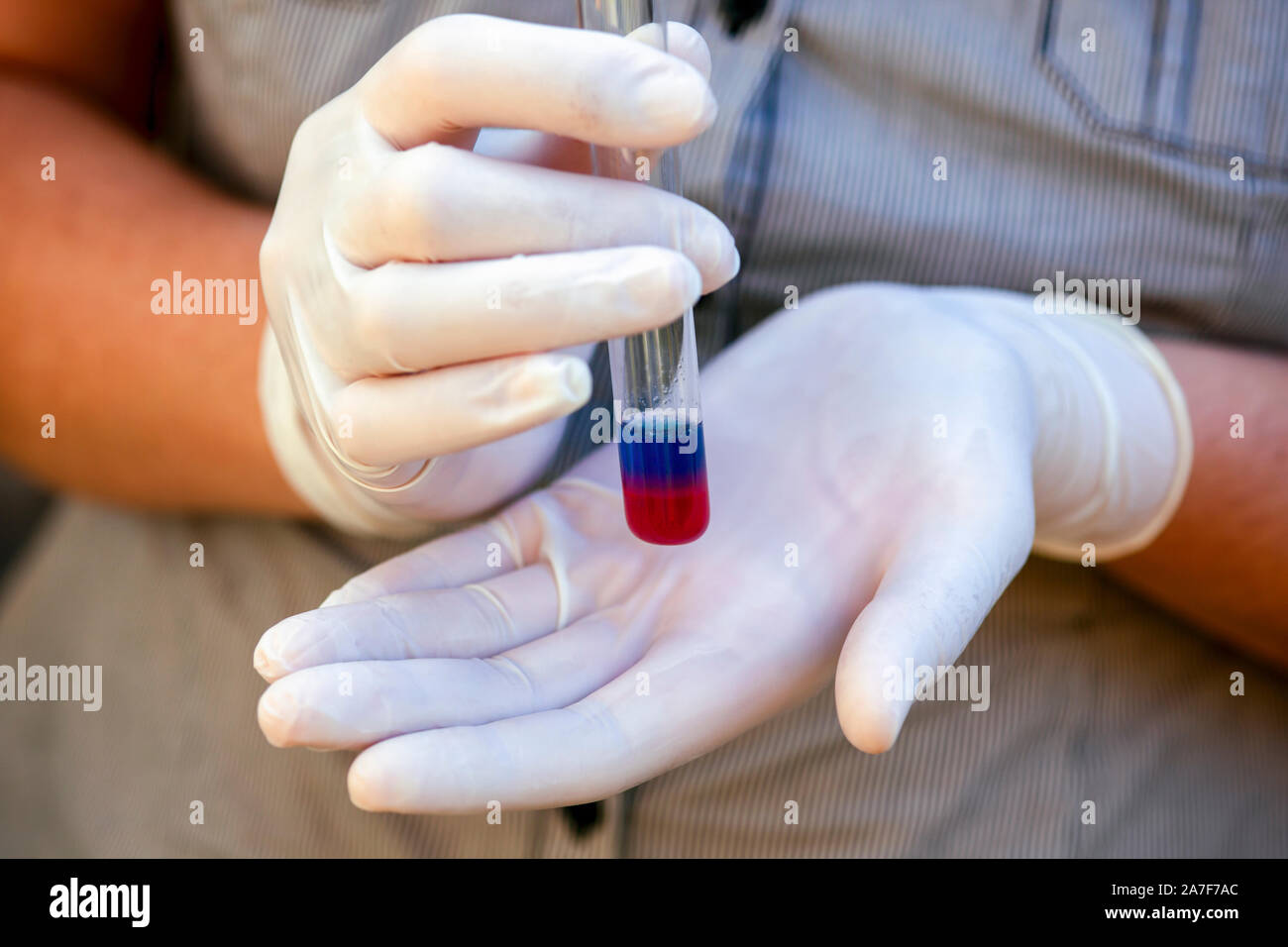 Woman hands in medical gloves making test in test tube Stock Photo - Alamy