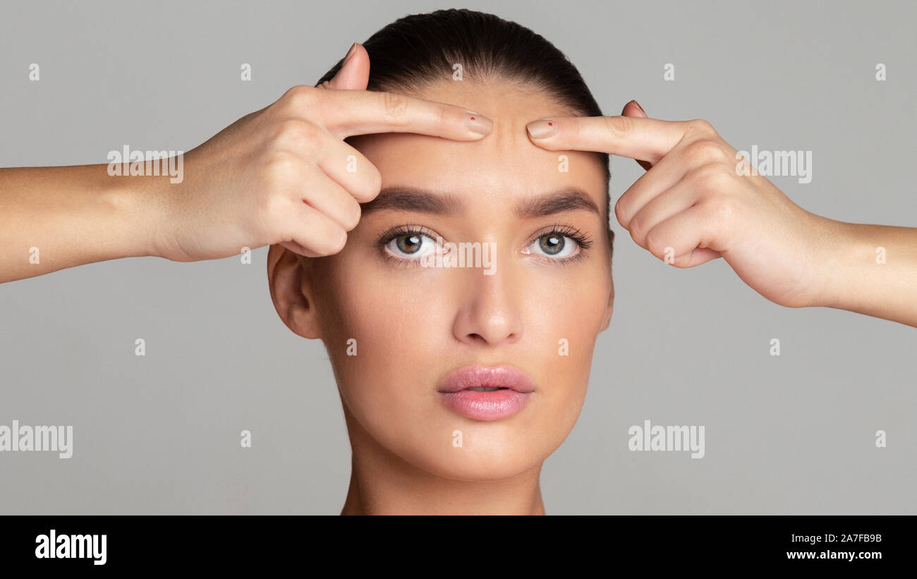 Problem skin. Girl crushing acne on her forehead Stock Photo - Alamy