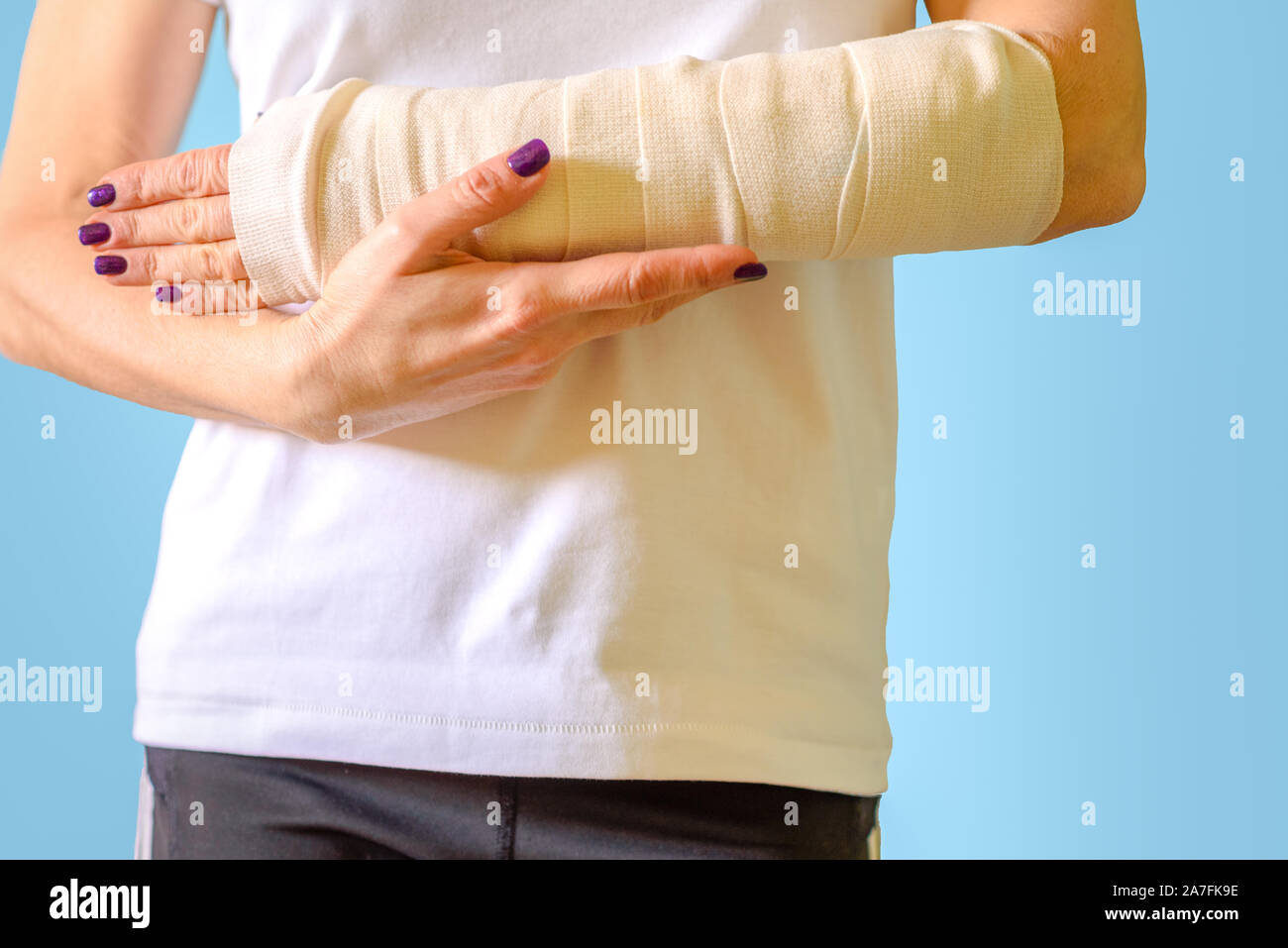 Woman arm cast hi-res stock photography and images - Alamy